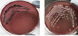 Laboratory analytical methods | Communicable Diseases Agency